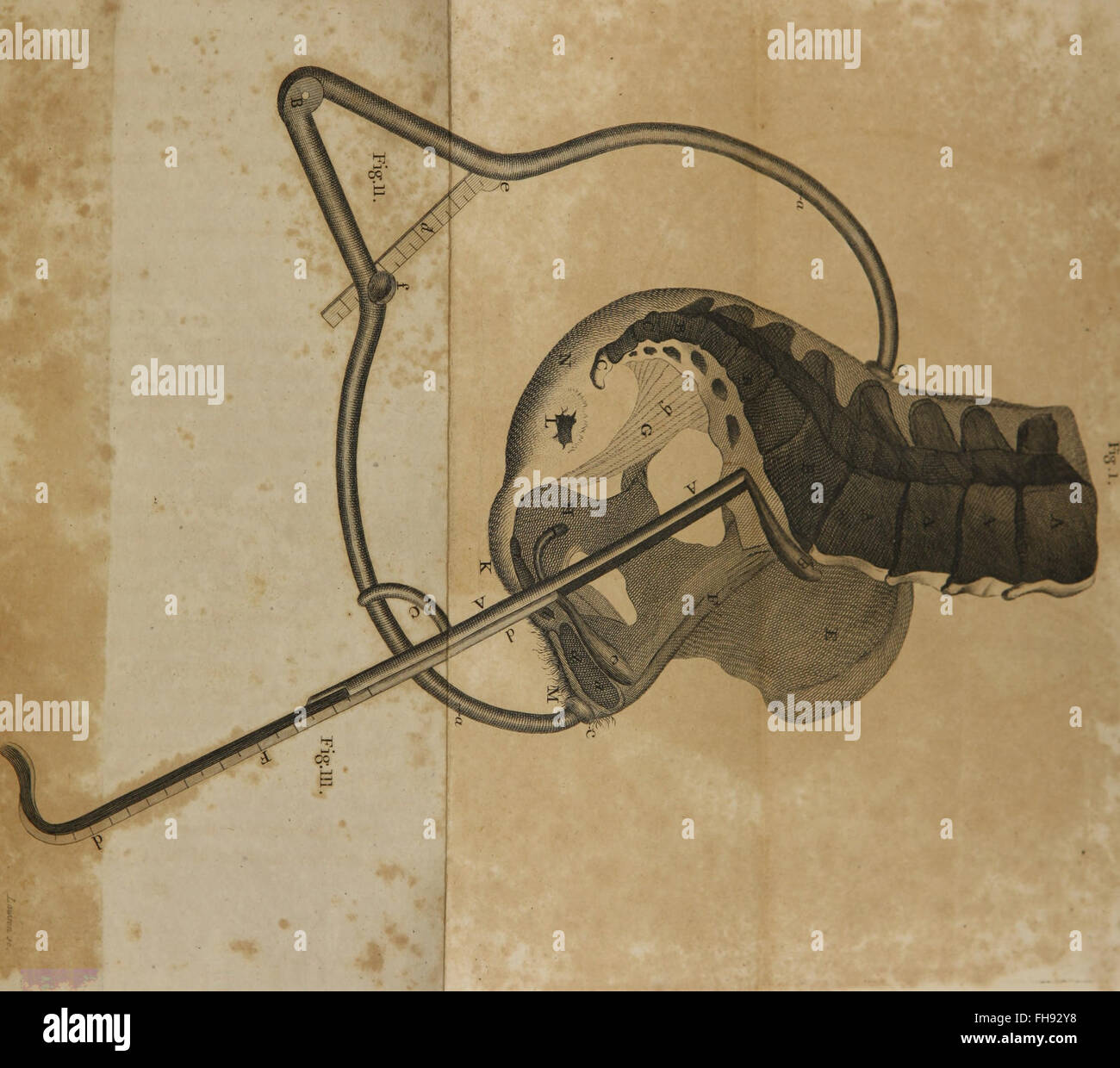 An Abridged Translation of Baudelocque's Midwifery by Mr. Heath (1807 ...