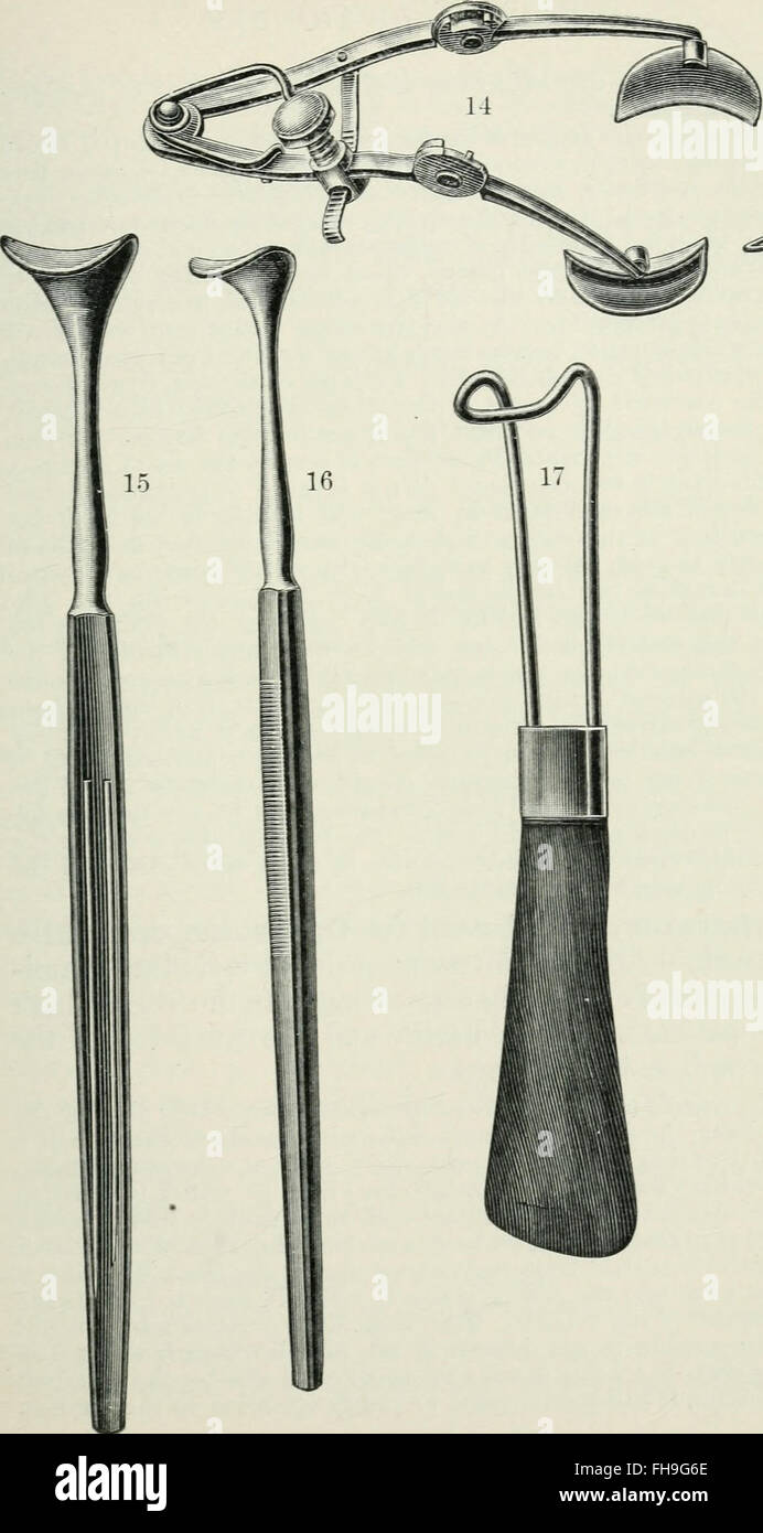 Atlas and Epitome of Operative Ophthalmology (1905), a comprehensive ...