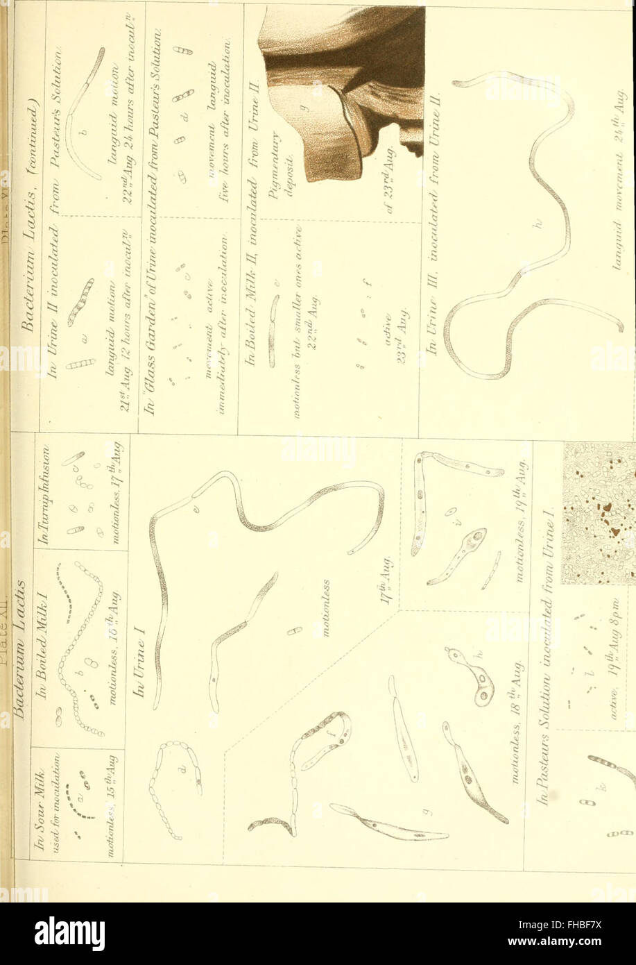 A compilation of the collected works of Joseph Lister, focusing on his ...