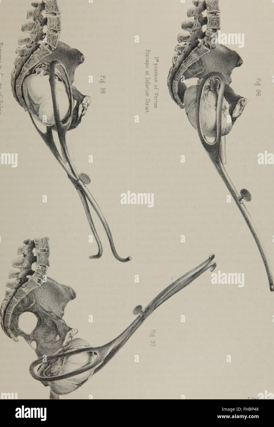 The principles and practice of obstetrics (1864 Stock Photo - Alamy