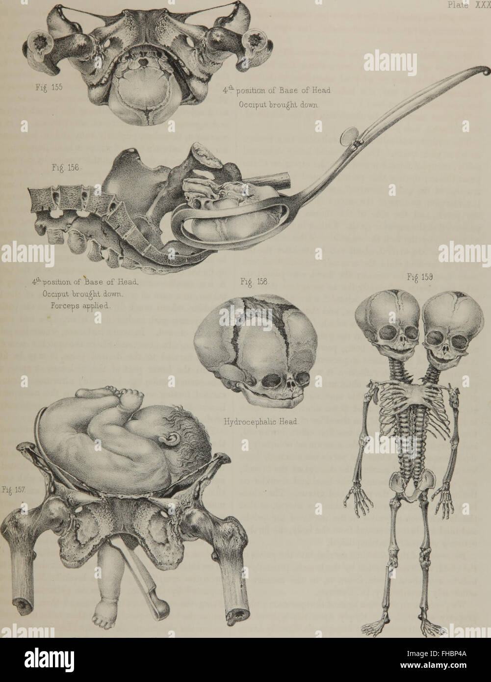 The principles and practice of obstetrics (1864 Stock Photo - Alamy