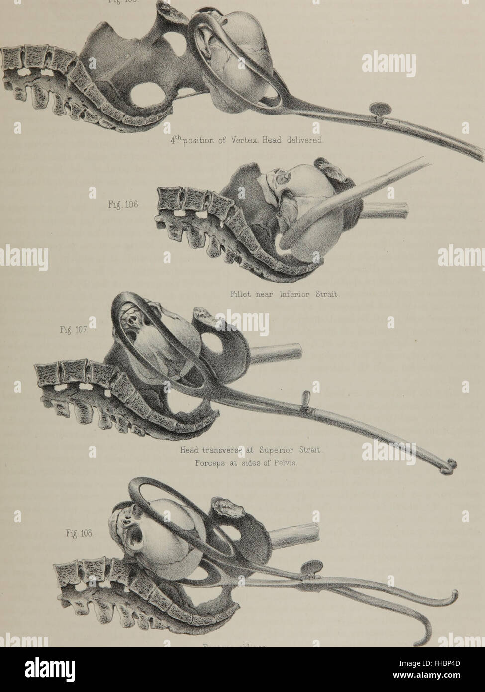 The Principles and Practice of Obstetrics (1864) is a historical ...