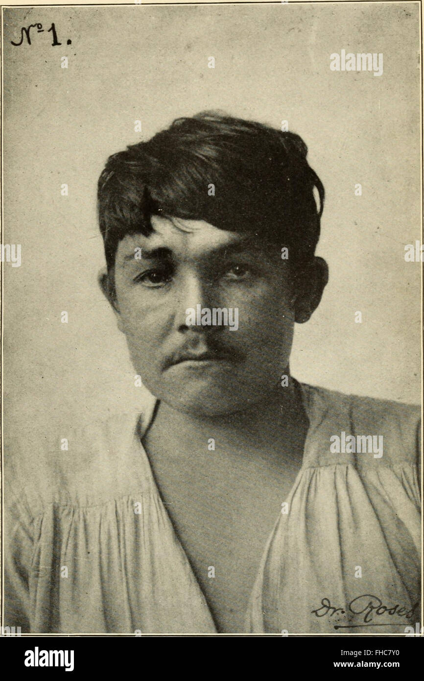 Uncinariasis (Hookworm disease) in Porto Rico - a medical and economic ...