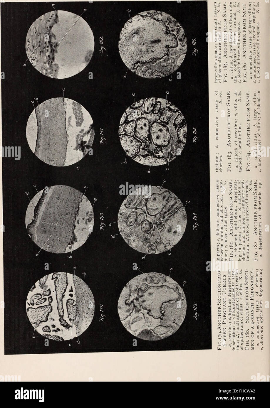 A 19th-century medical journal covering advancements in gynecology and ...