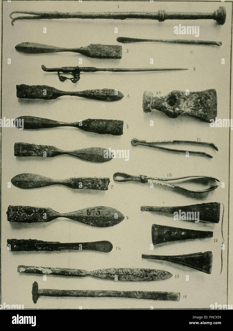A 1909 medical work focusing on the presence of foreign bodies, worms ...