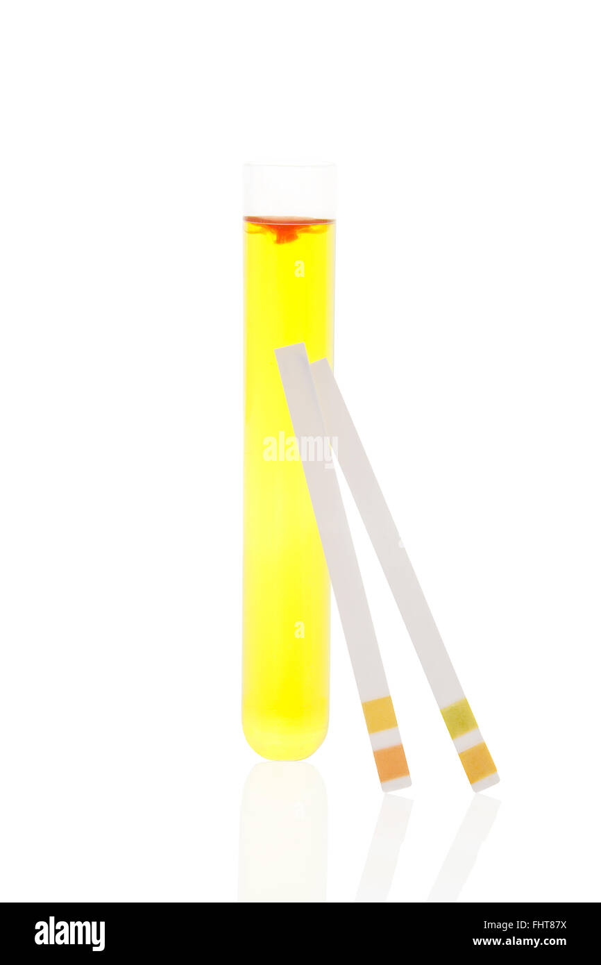 Urine in test tube and pH test strips Stock Photo - Alamy