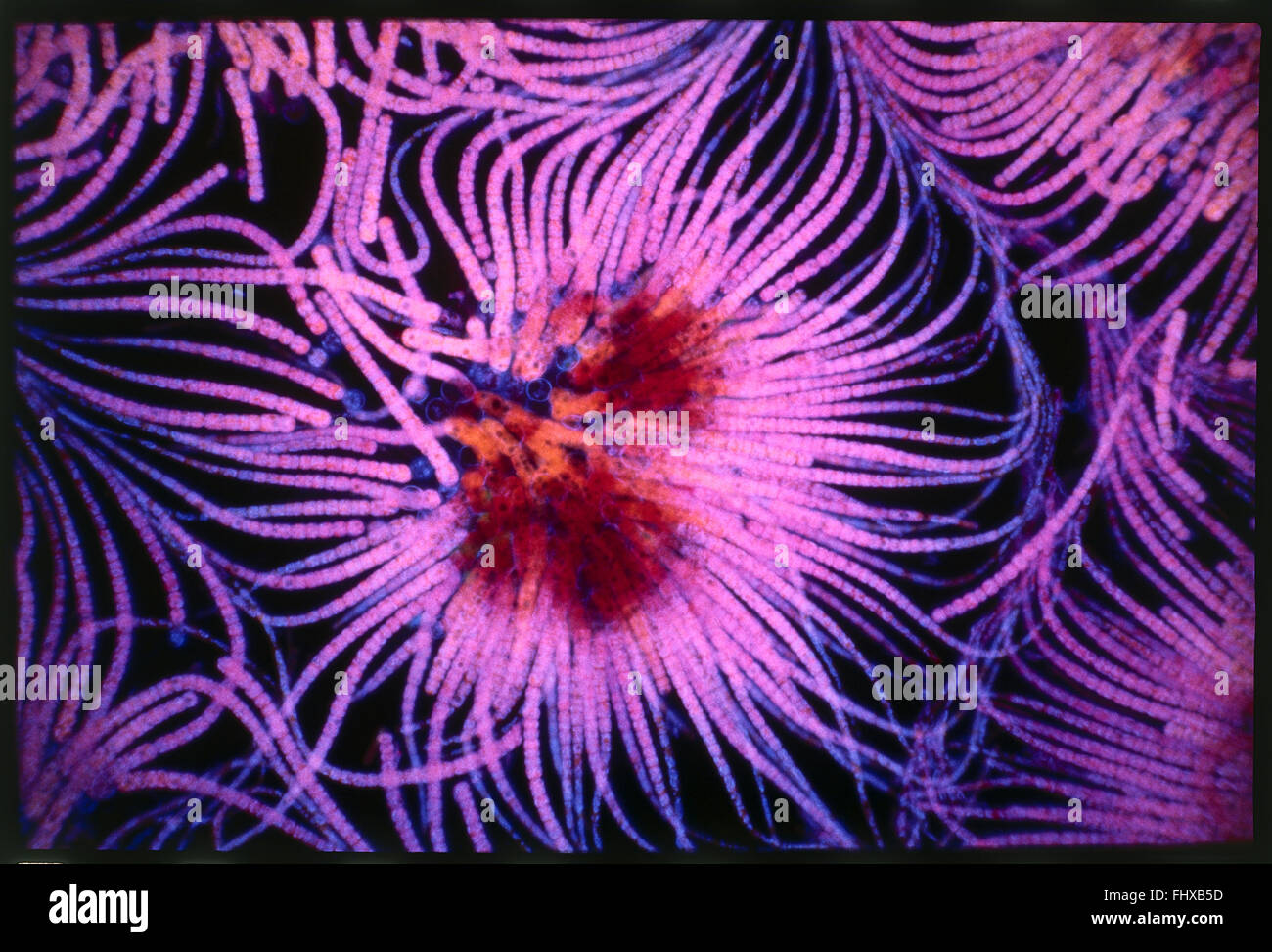 Slide showing cluster of a single celled organism called cyanobacteria ...