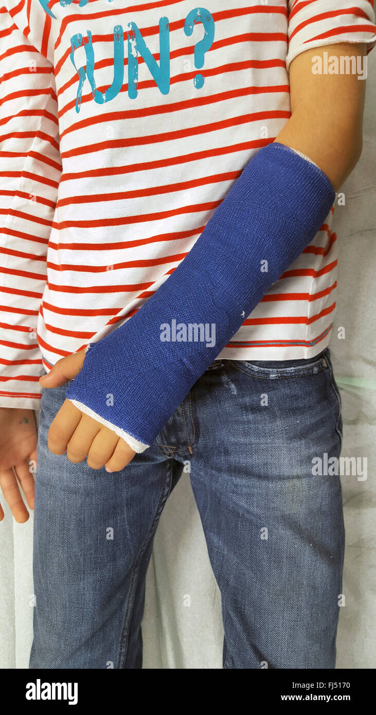 Plaster After Wrist Fracture High Resolution Stock Photography and ...
