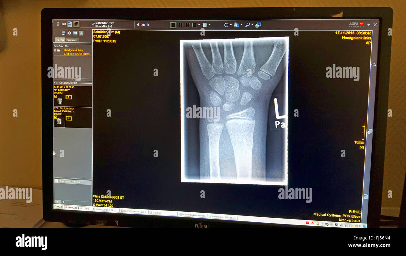 Radiographs monitor hi-res stock photography and images - Alamy