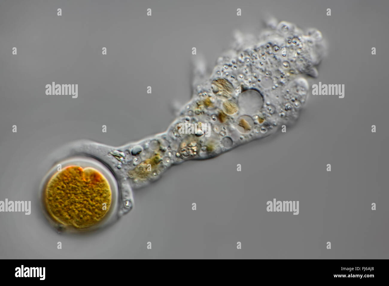 Amoeba 400x Magnification