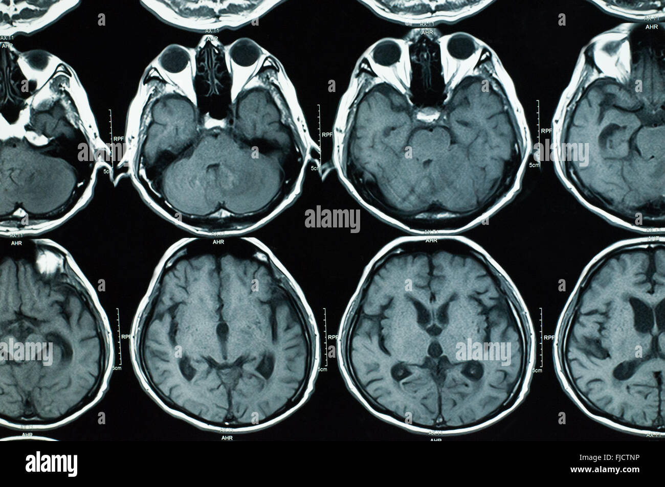 research in medicine. CT scan of the patient Stock Photo - Alamy
