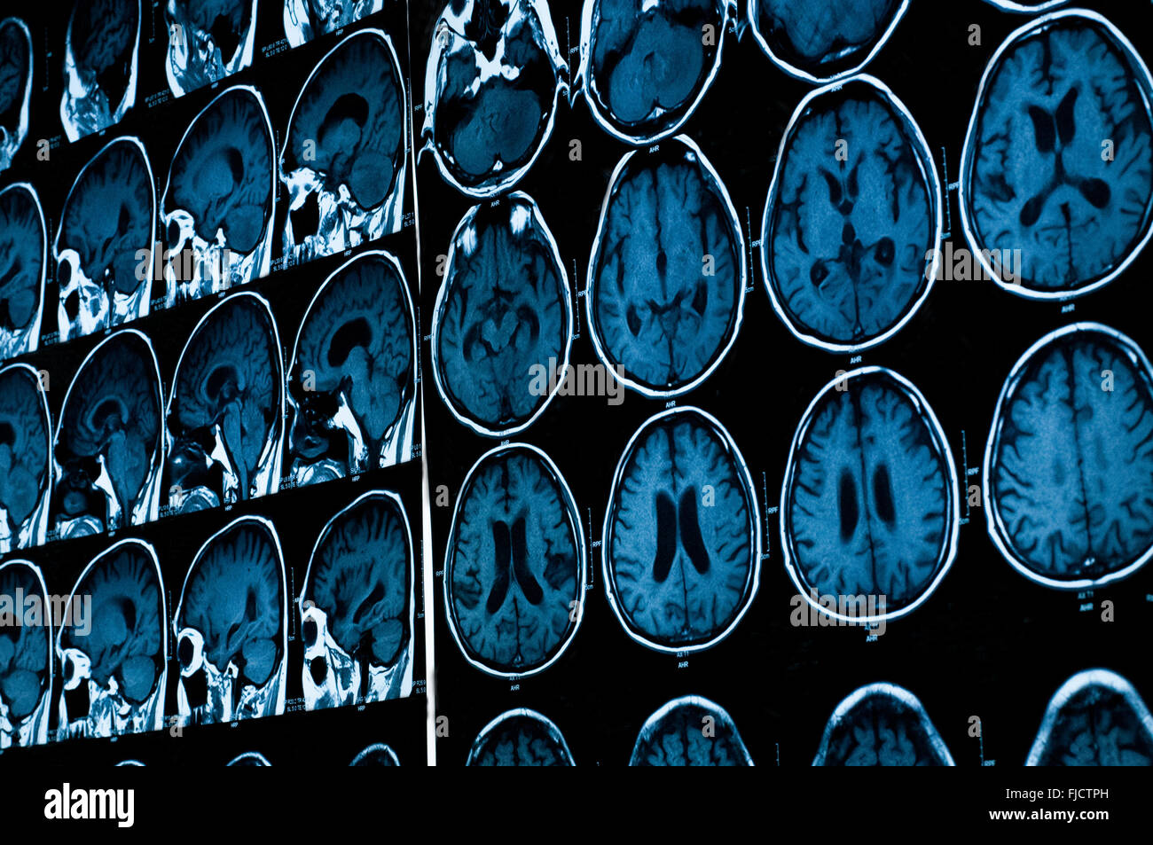 research in medicine. CT scan of the patient Stock Photo - Alamy