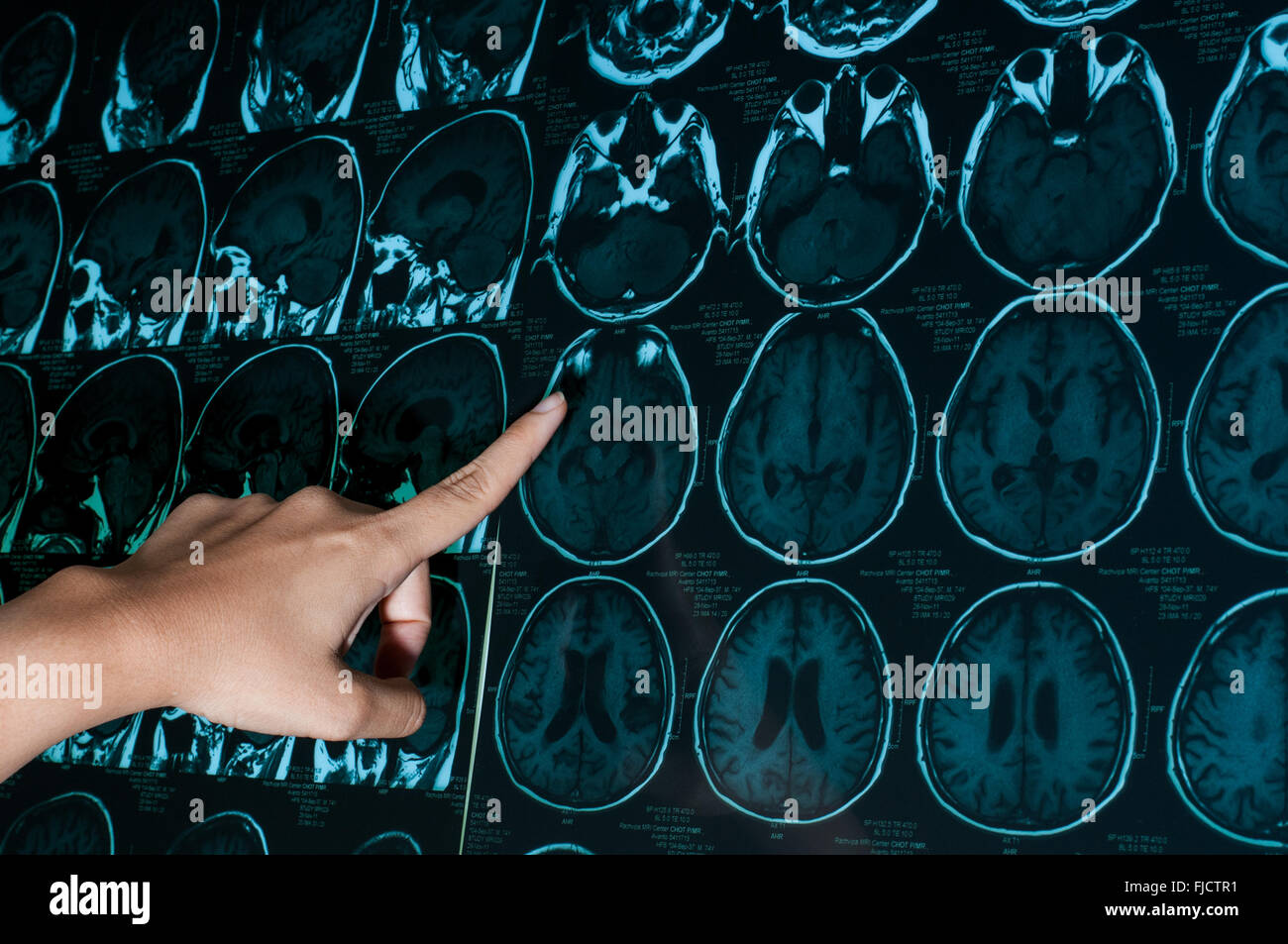 research in medicine. CT scan of the patient Stock Photo - Alamy