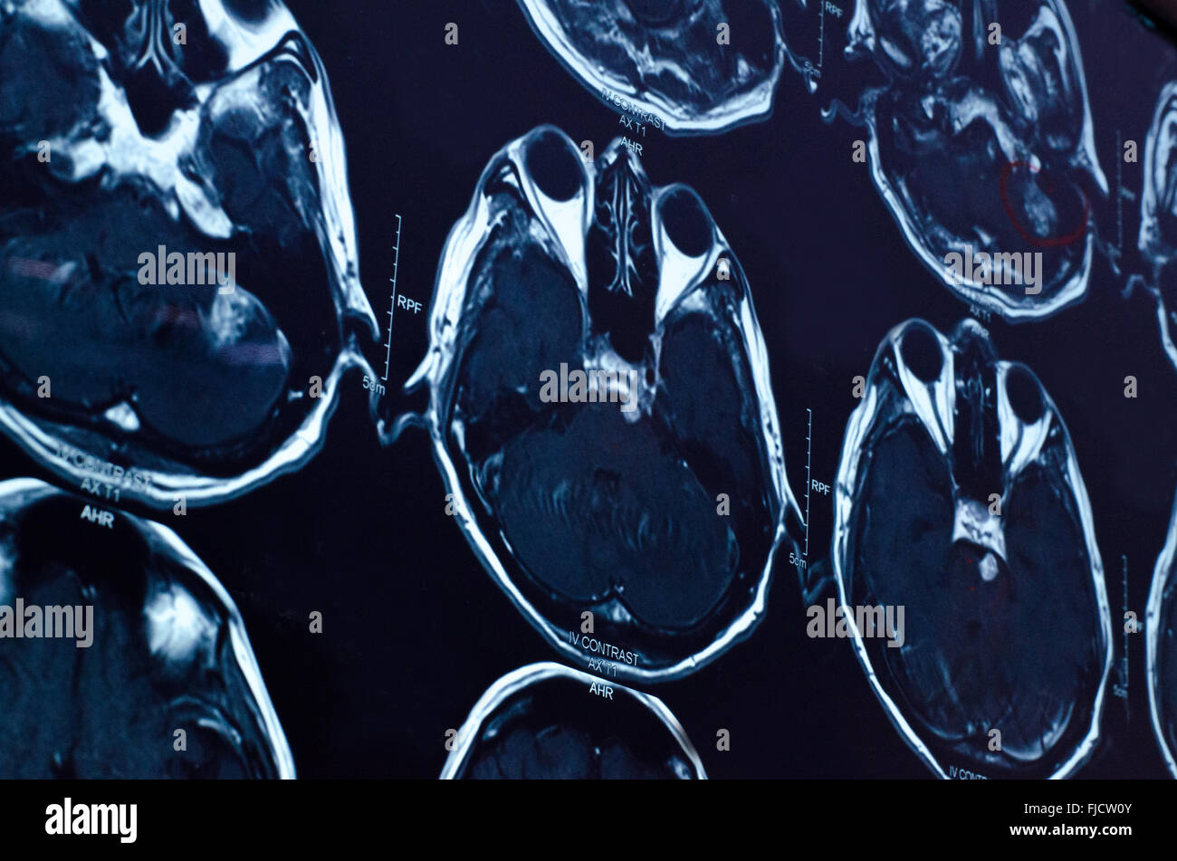 research in medicine. CT scan of the patient Stock Photo - Alamy