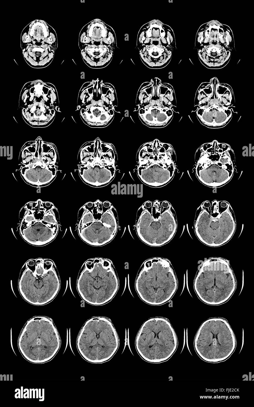 research in medicine. CT scan of the patient Stock Photo - Alamy