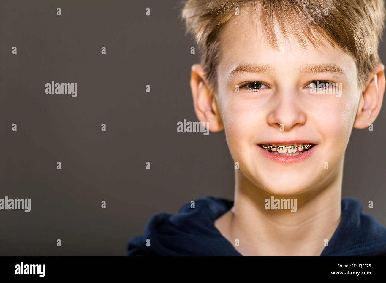 School Child Wears Braces Hi Res Stock Photography And Images Alamy