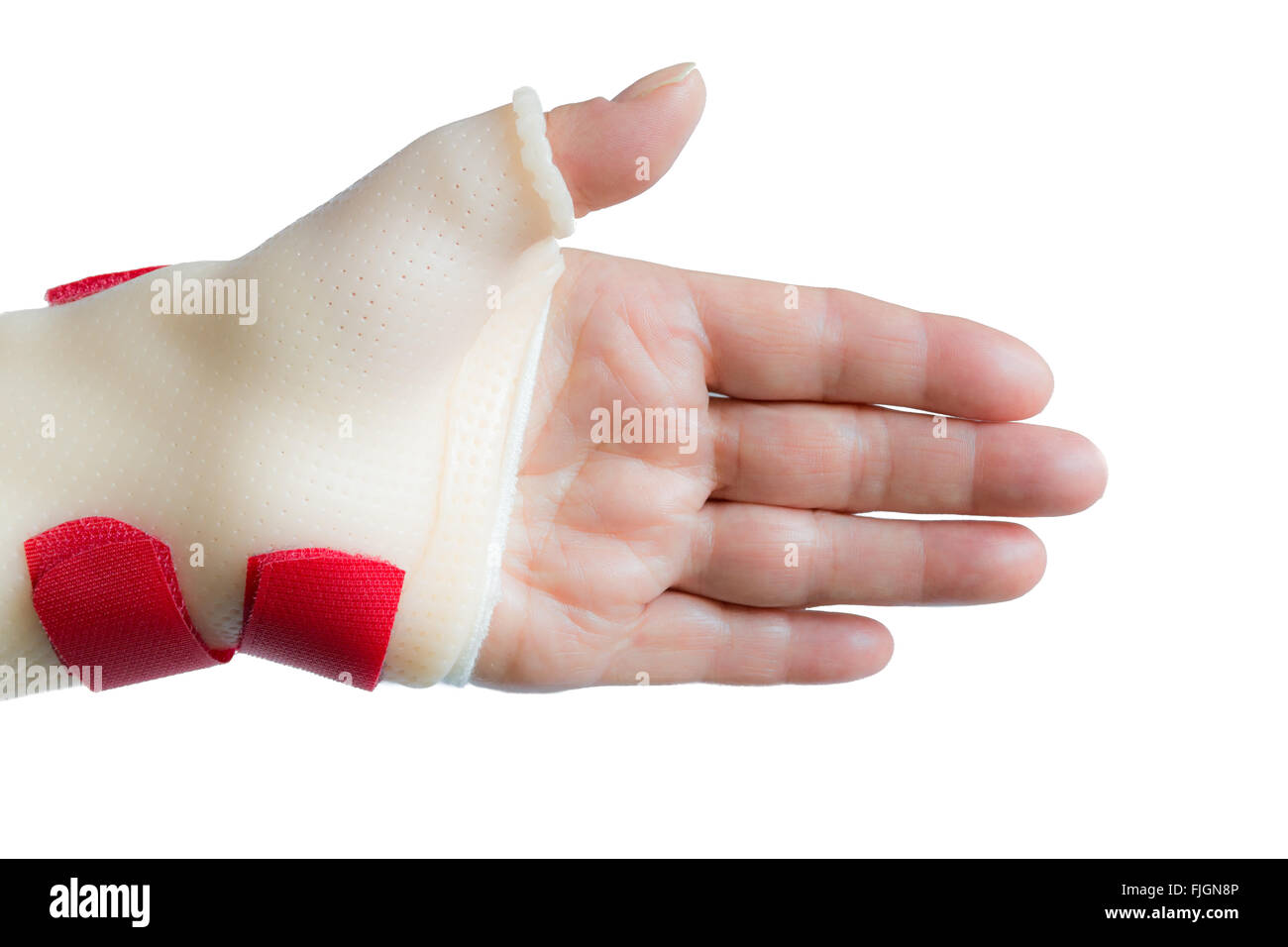 Hand splint hi-res stock photography and images - Alamy