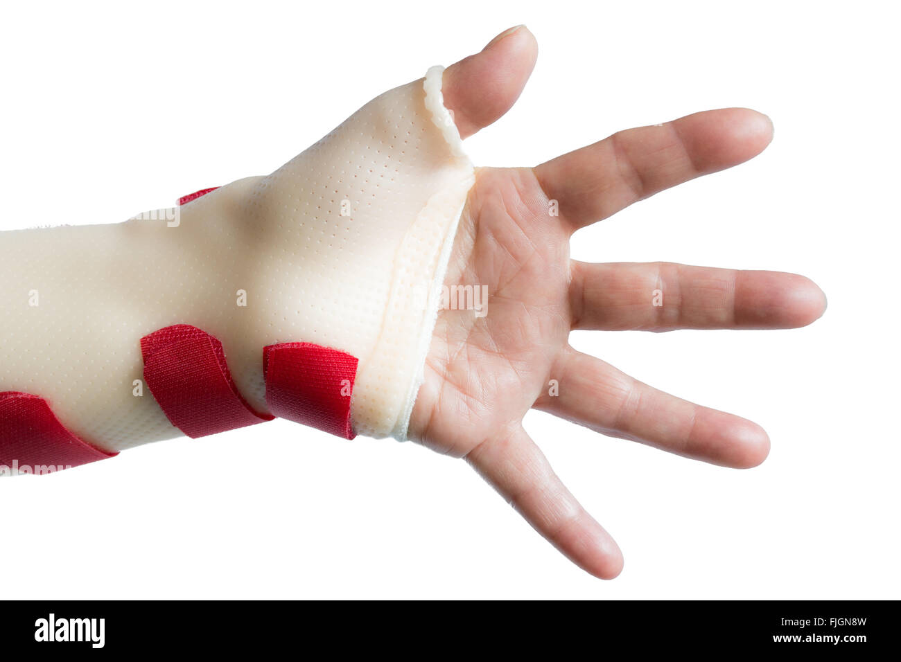 Hand Splint Stock Photos & Hand Splint Stock Images - Alamy