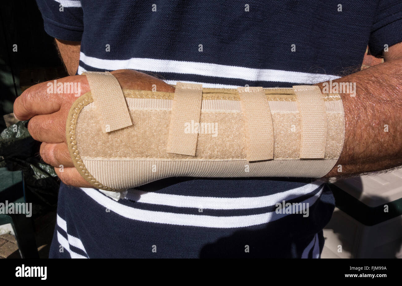 Wrist fracture hi-res stock photography and images - Alamy