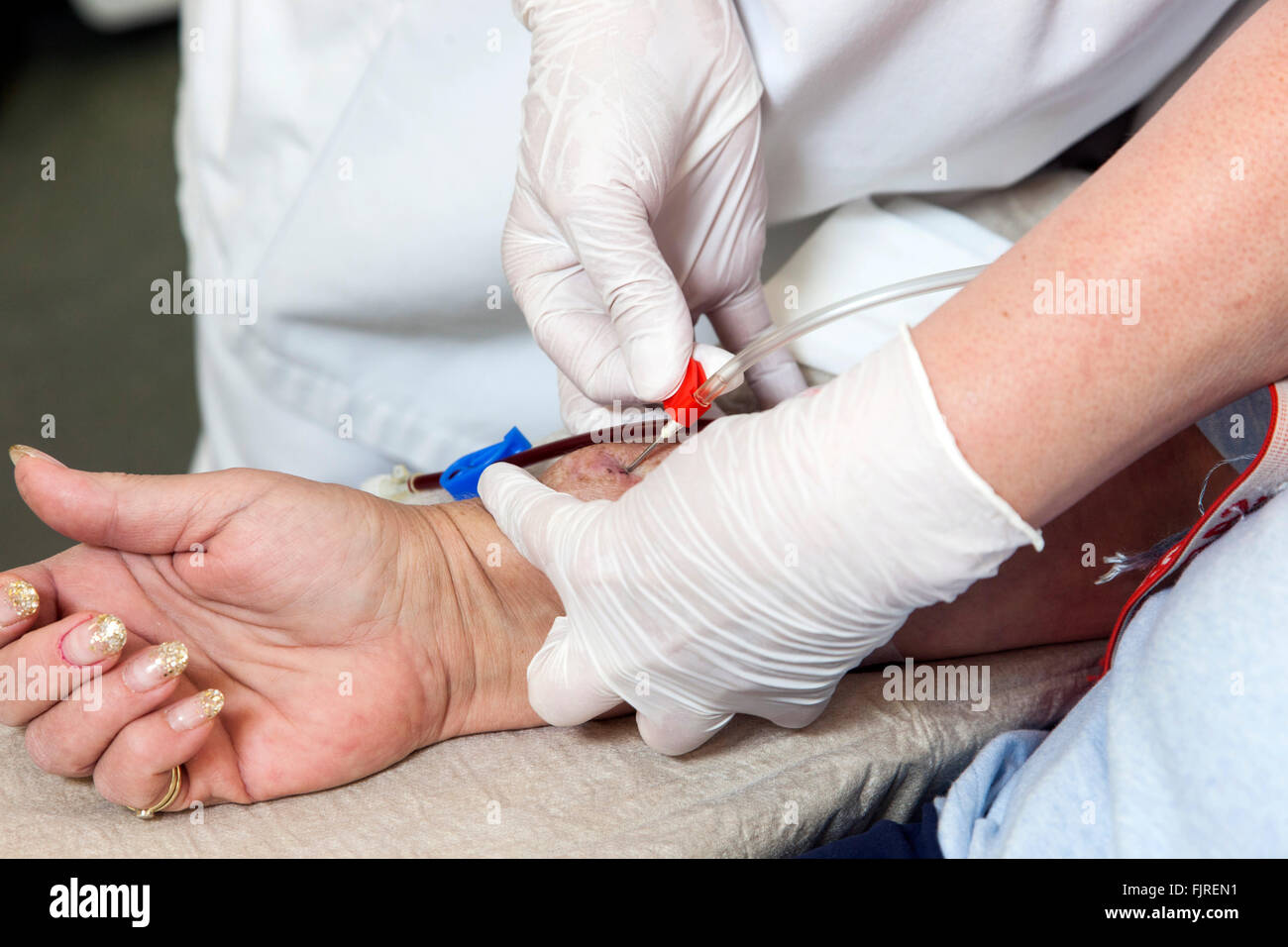 Kidney dialysis machine hi-res stock photography and images - Alamy