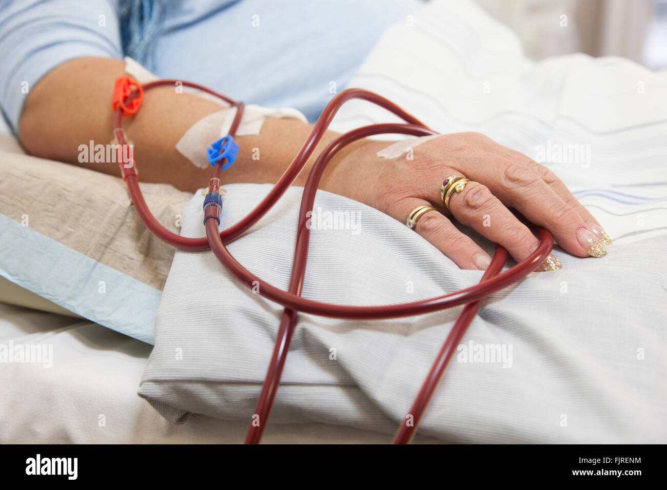 Dialysis hi-res stock photography and images - Alamy
