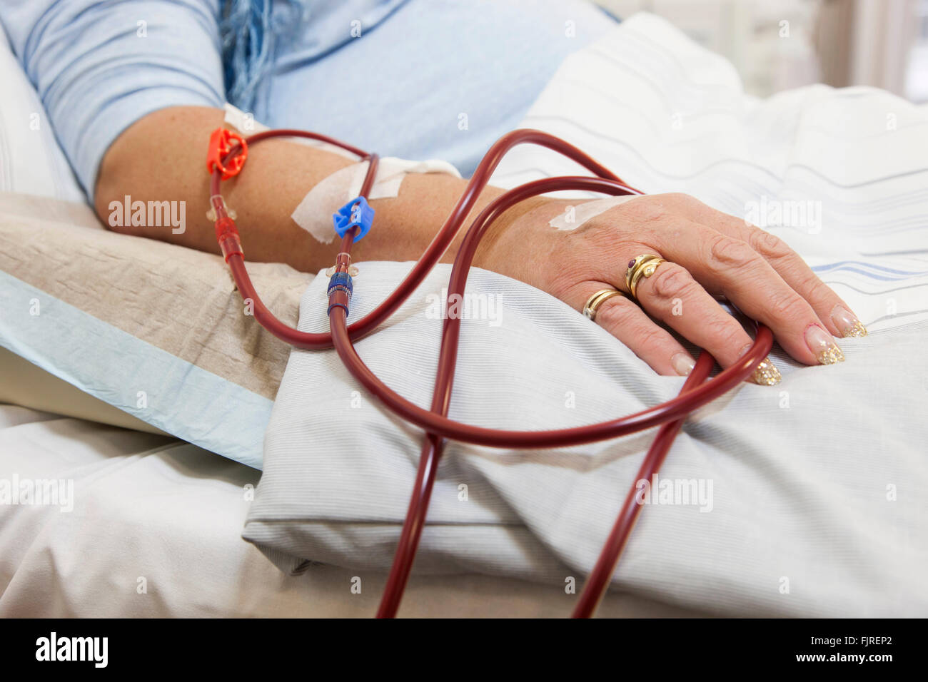 Renal dialysis shunt hi-res stock photography and images - Alamy