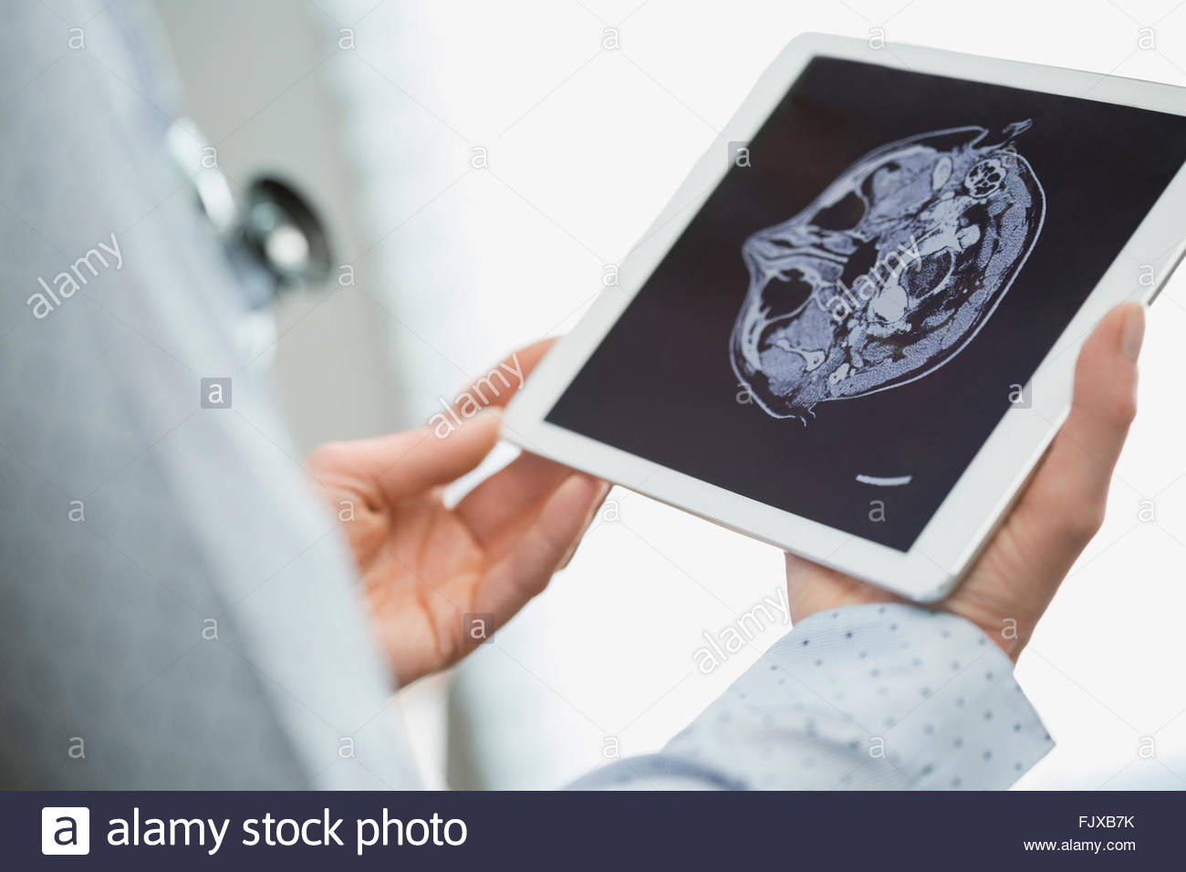 X ray scan brain hi-res stock photography and images - Alamy