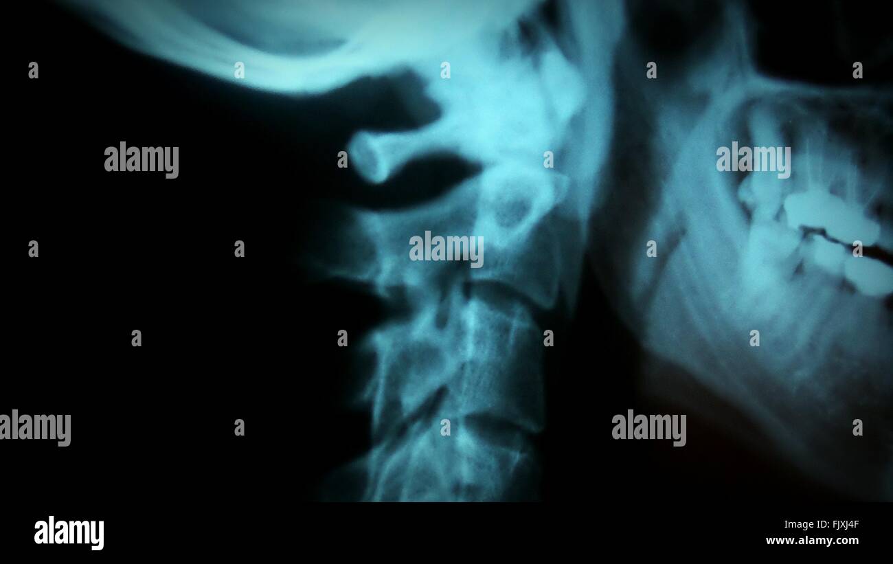 No spine hi-res stock photography and images - Alamy
