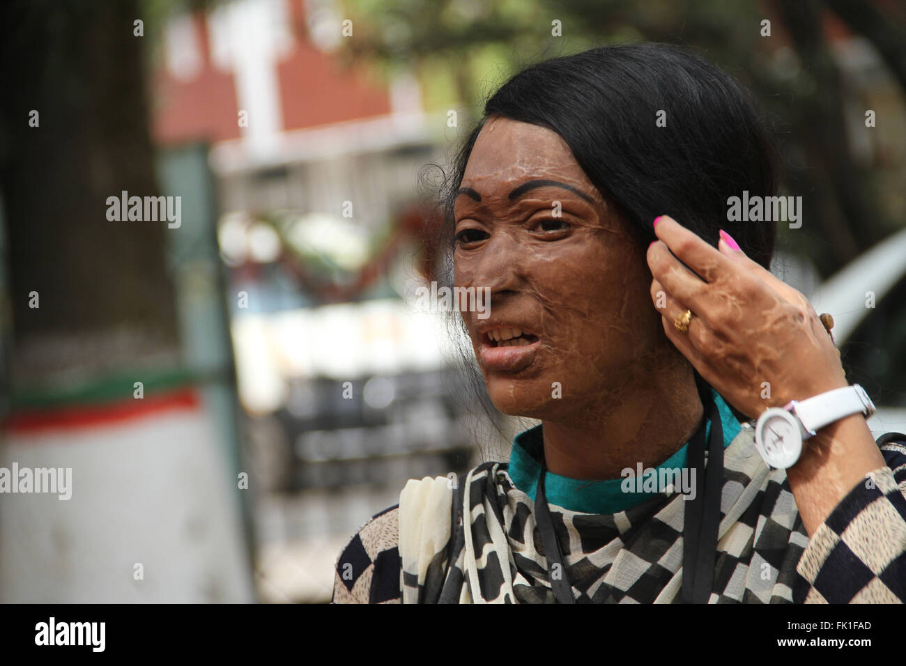 Female victim acid hi-res stock photography and images - Alamy