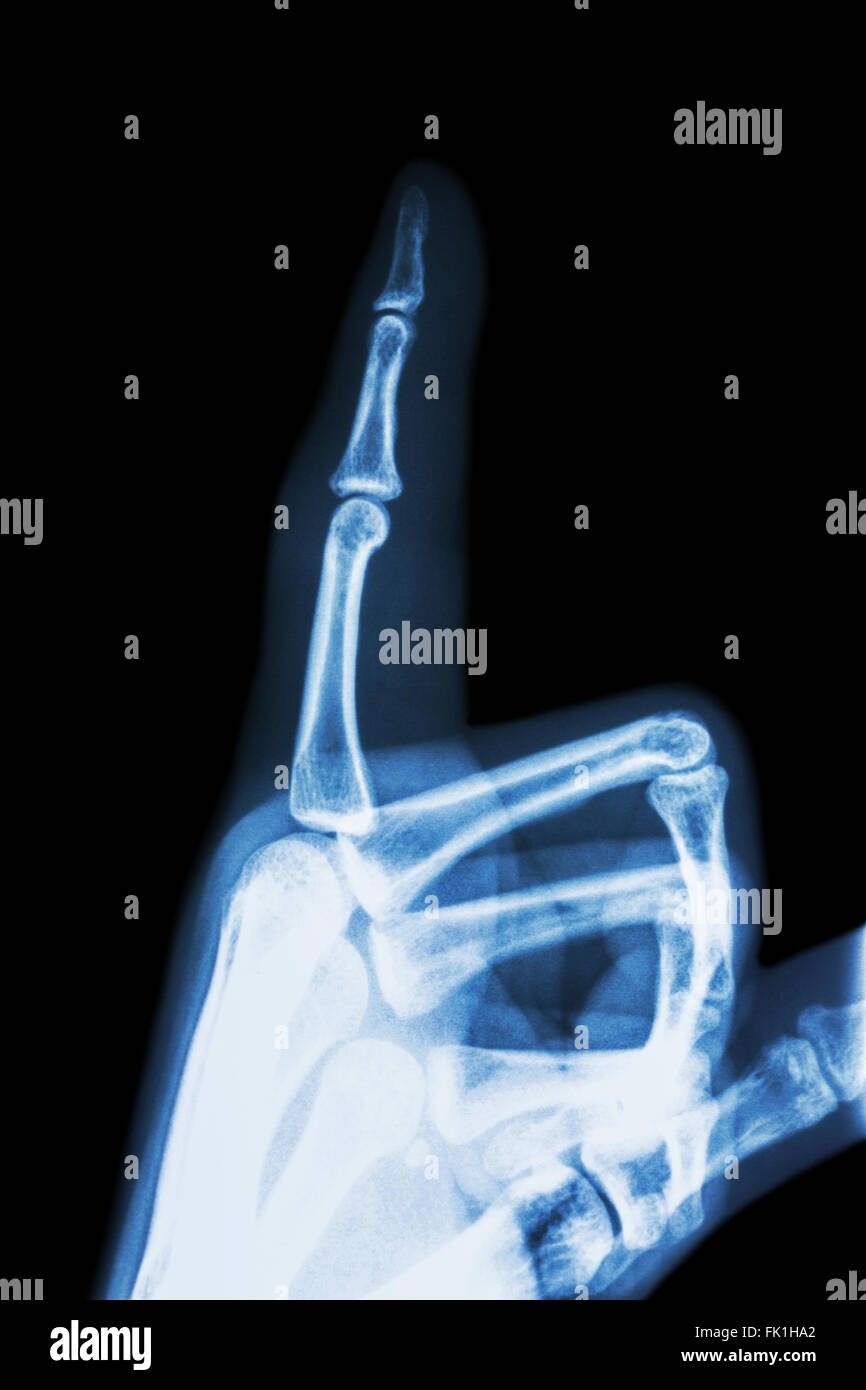 Lateral raise hi-res stock photography and images - Alamy