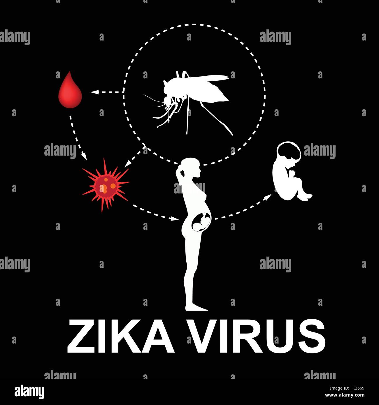 Conjunctivitis diagram Stock Vector Images - Alamy