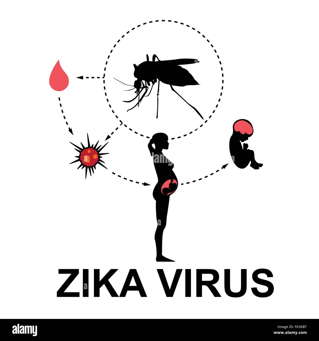 Zika virus infection pregnancy illustration hi-res stock photography ...
