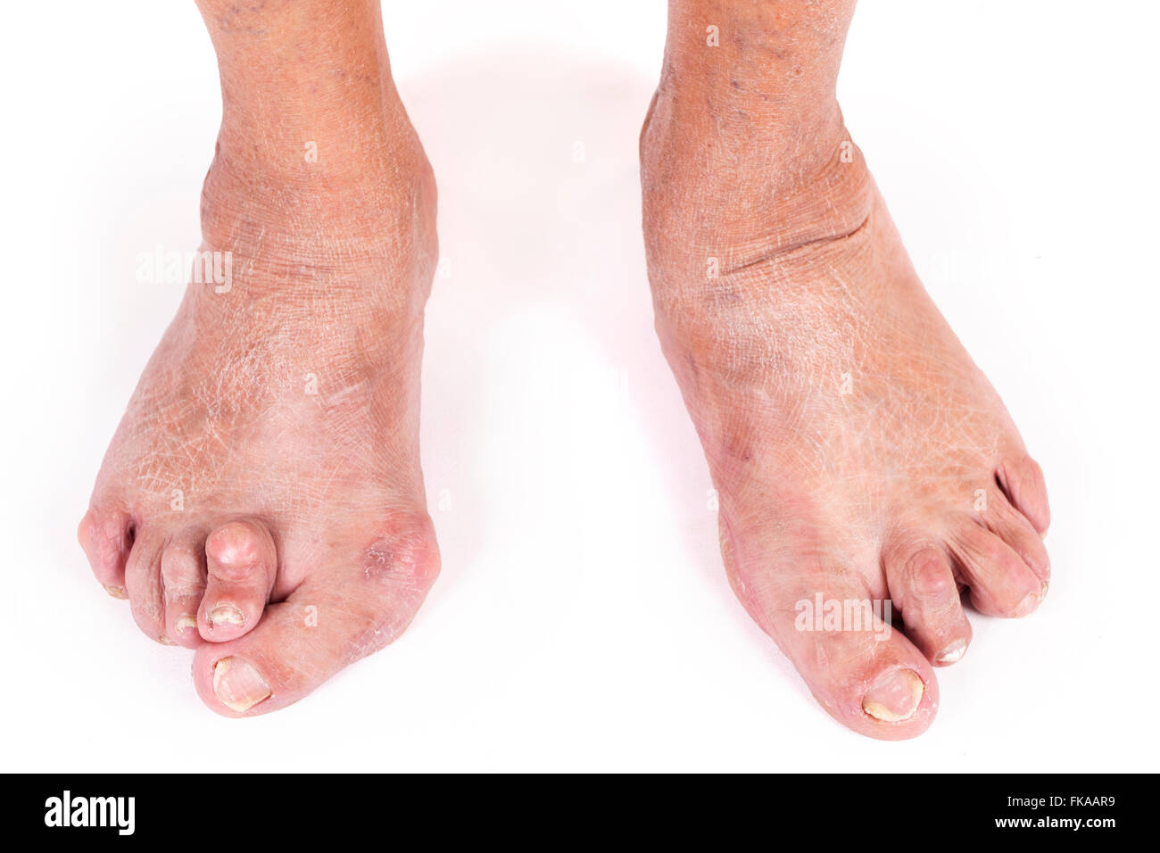 Advanced treatment Cut Out Stock Images & Pictures - Alamy