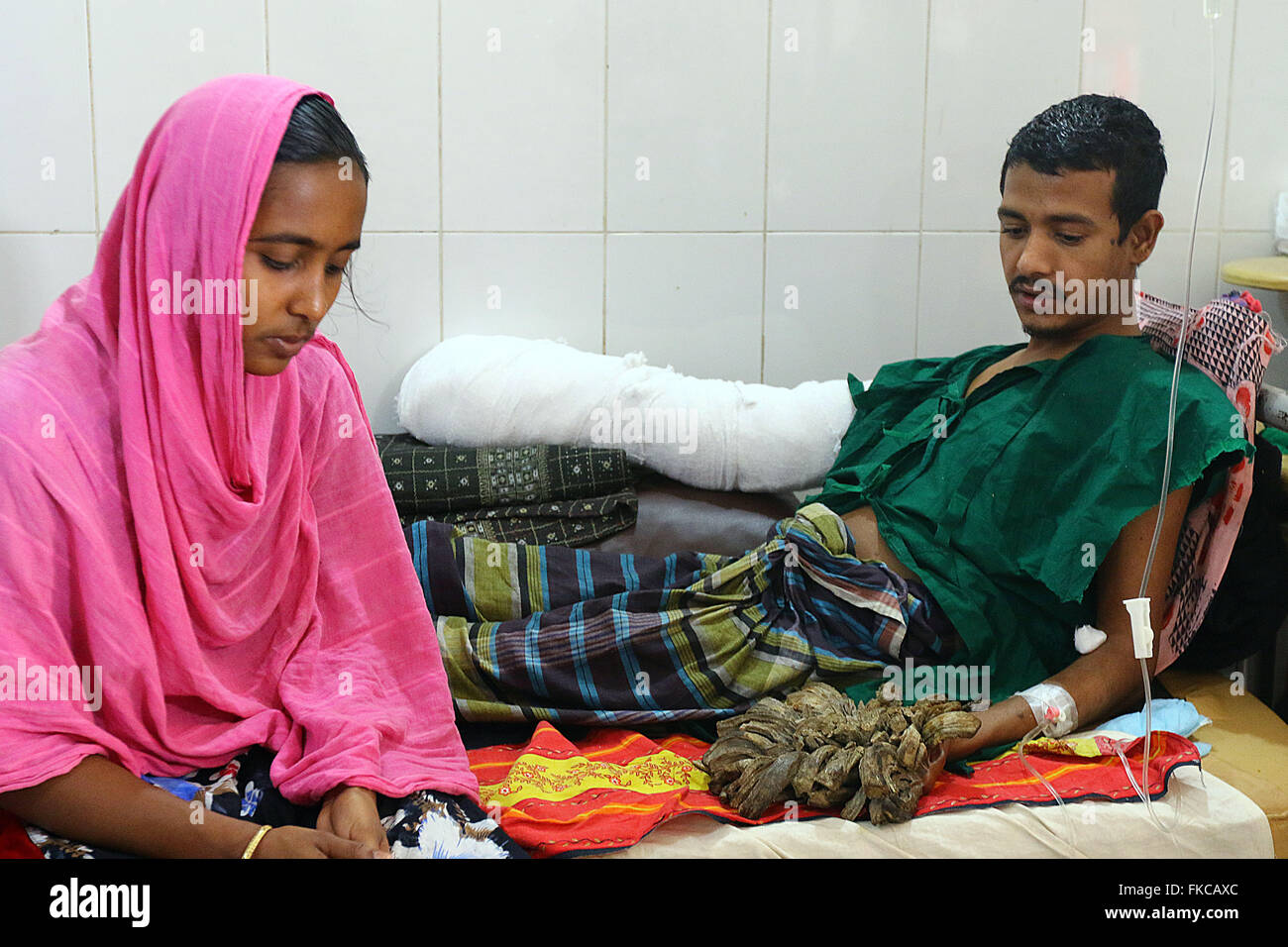 Bangladeshi Tree man Abdul Bajander rests after a surgery at Dhaka ...