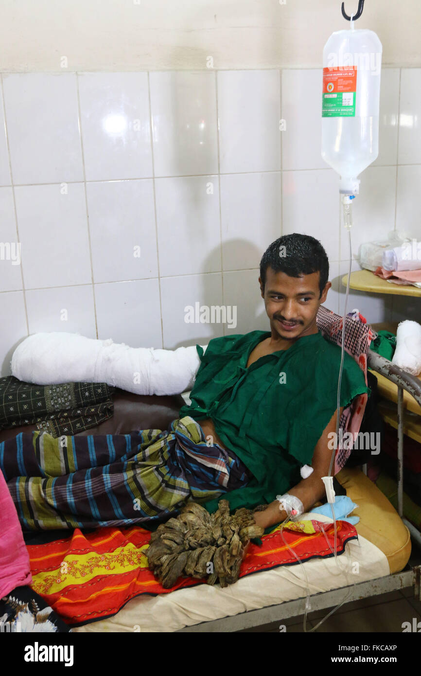 Bangladeshi Tree man Abdul Bajander rests after a surgery at Dhaka ...