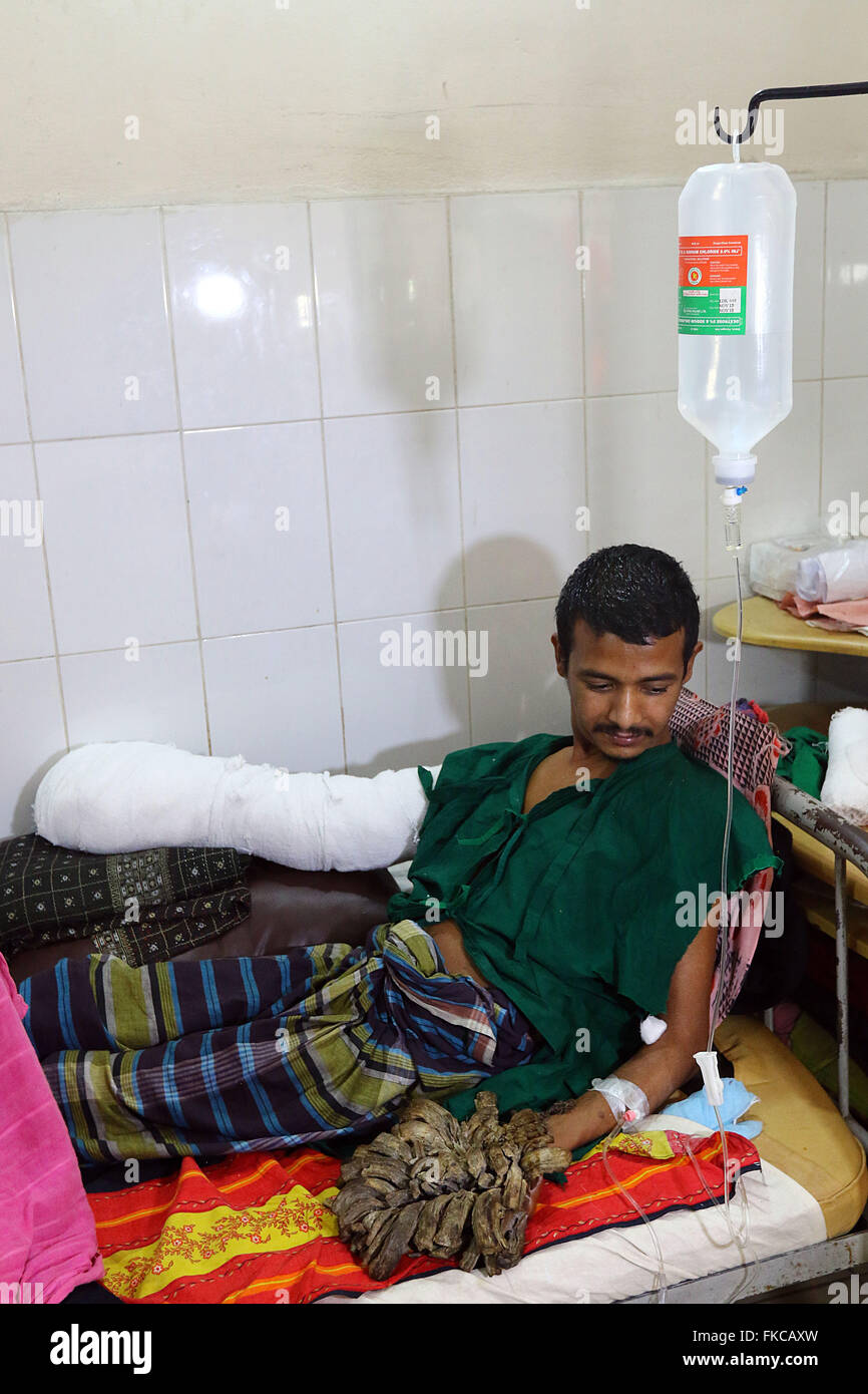 Bangladeshi Tree Man Abdul Bajander Rests After A Surgery At Dhaka