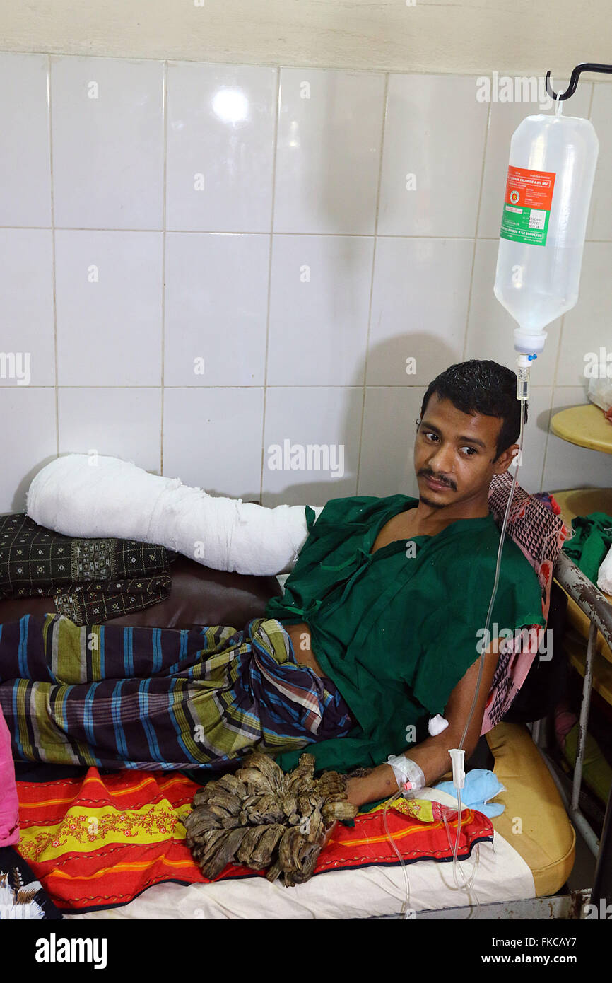 Bangladeshi Tree man Abdul Bajander rests after a surgery at Dhaka ...