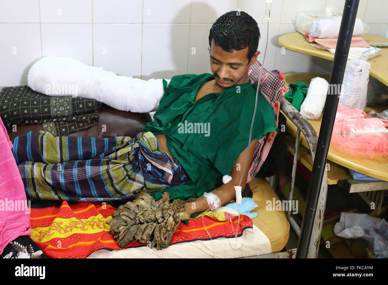 Bangladeshi Tree man Abdul Bajander rests after a surgery at Dhaka ...