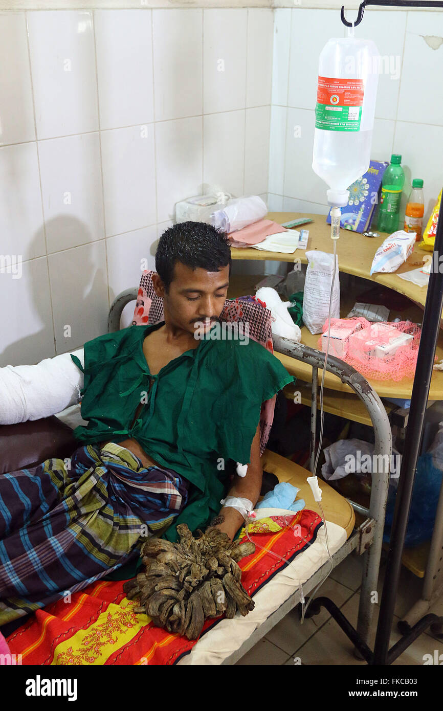 Bangladeshi Tree Man Abdul Bajander Rests After A Surgery At Dhaka