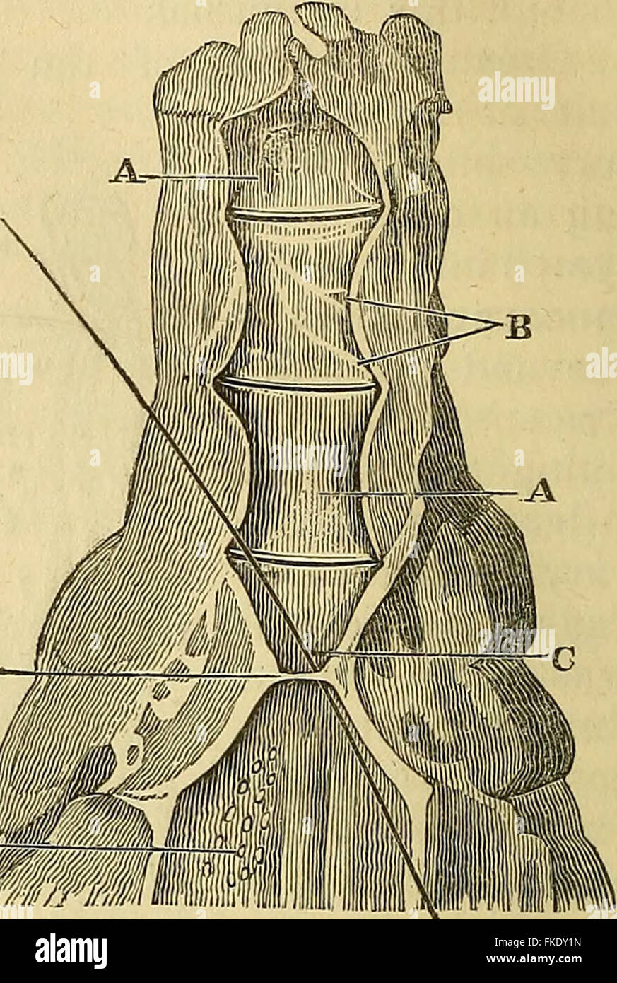 "Elements of pathological anatomy" (1843 Stock Photo - Alamy