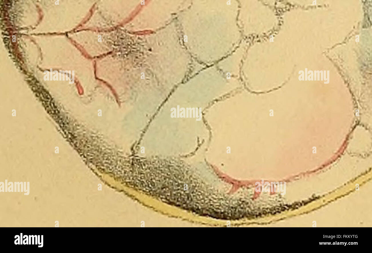 "Elements of pathological anatomy" (1843 Stock Photo - Alamy