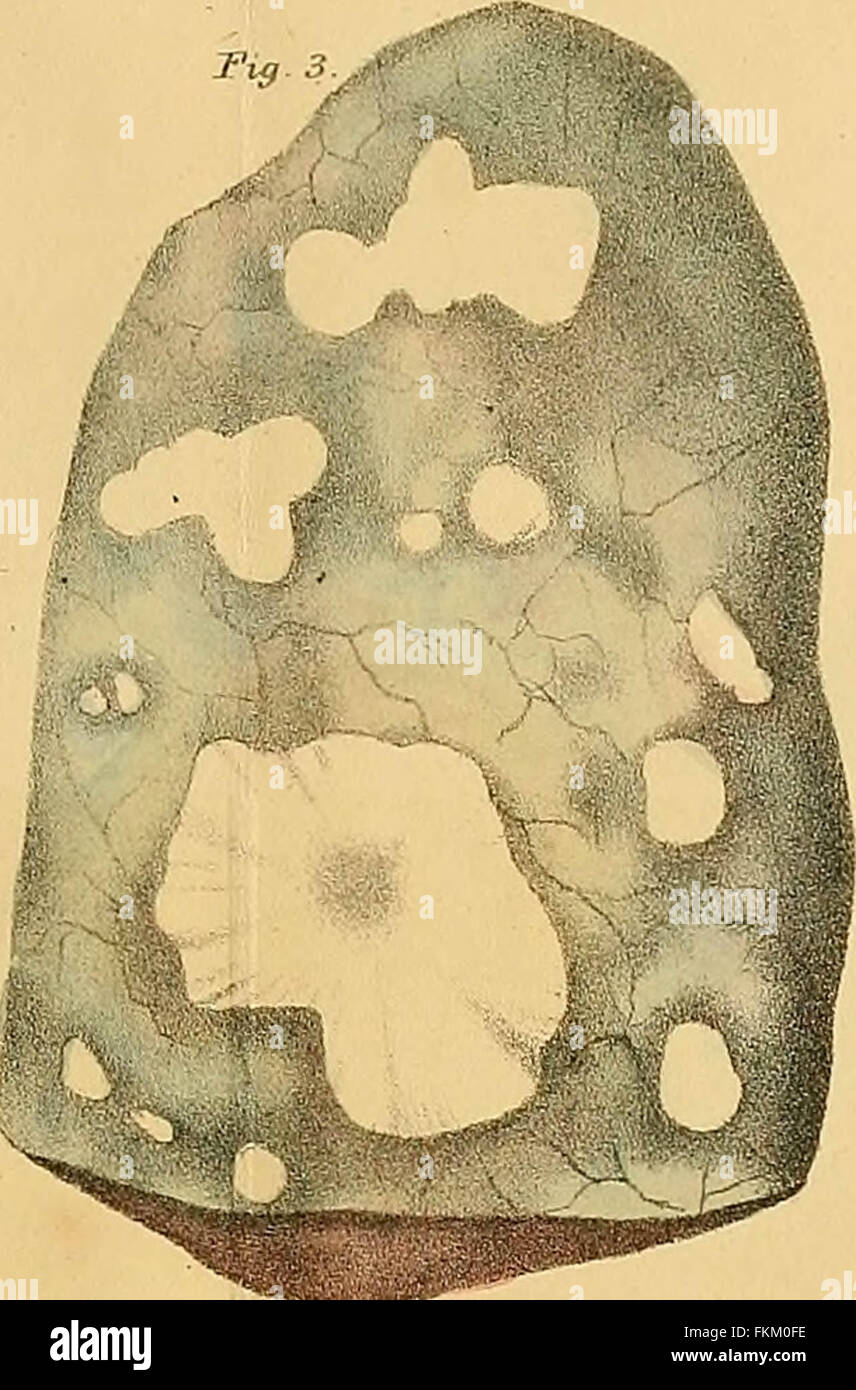 "Elements of pathological anatomy" (1843 Stock Photo - Alamy