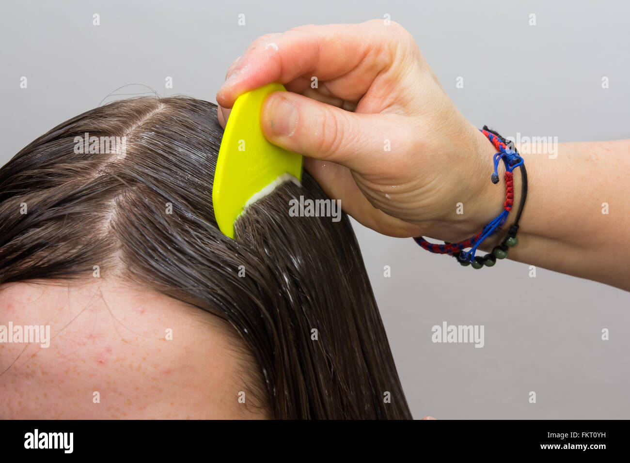 Lice hi-res stock photography and images - Alamy