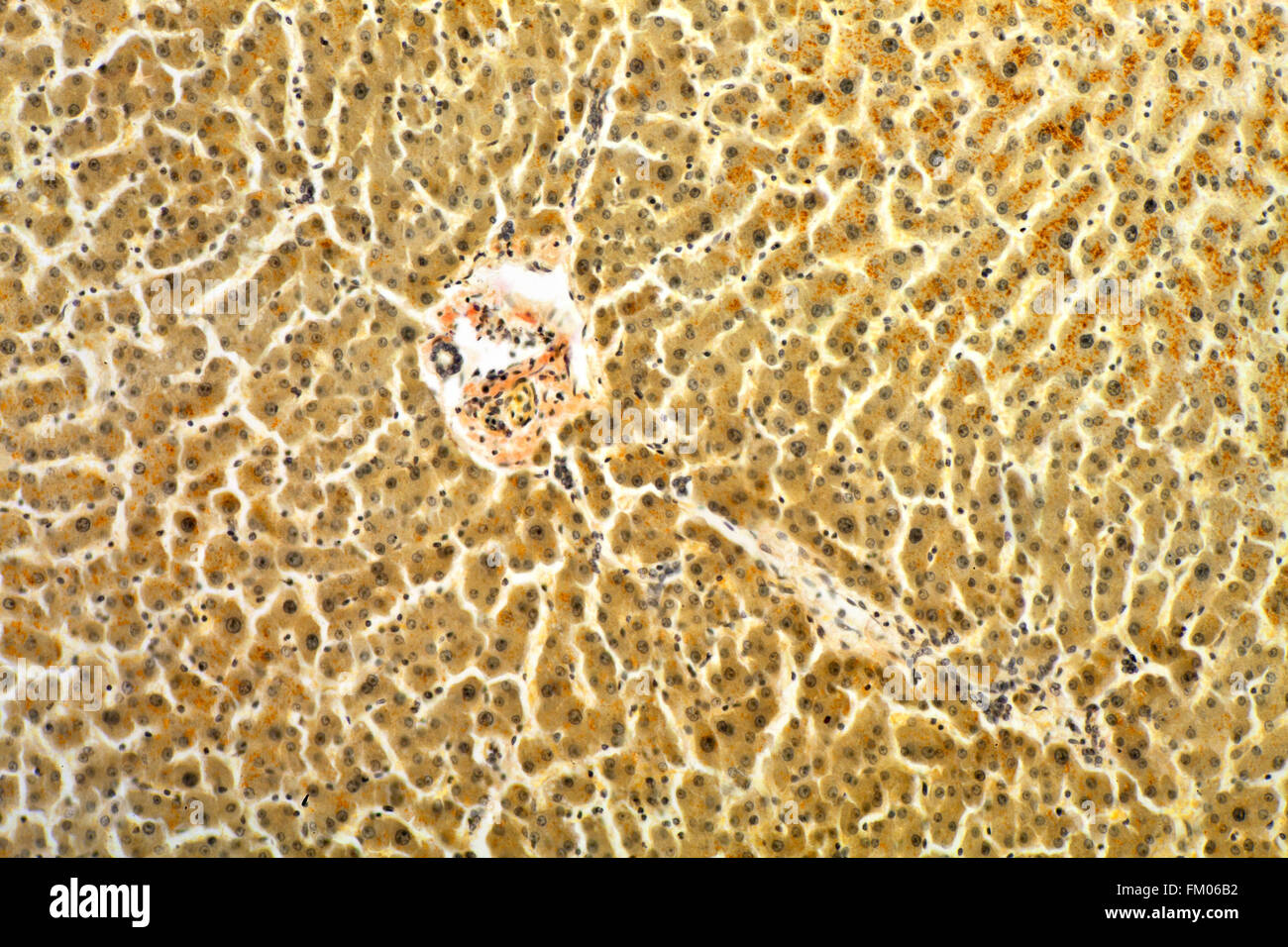 Liver stained slide section, brightfield photomicrograph Stock Photo ...
