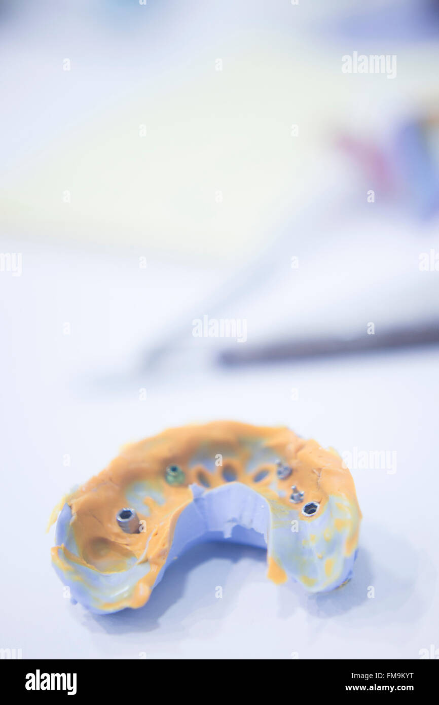 Dental mold dental impression plate in dentist's clinic Stock Photo - Alamy