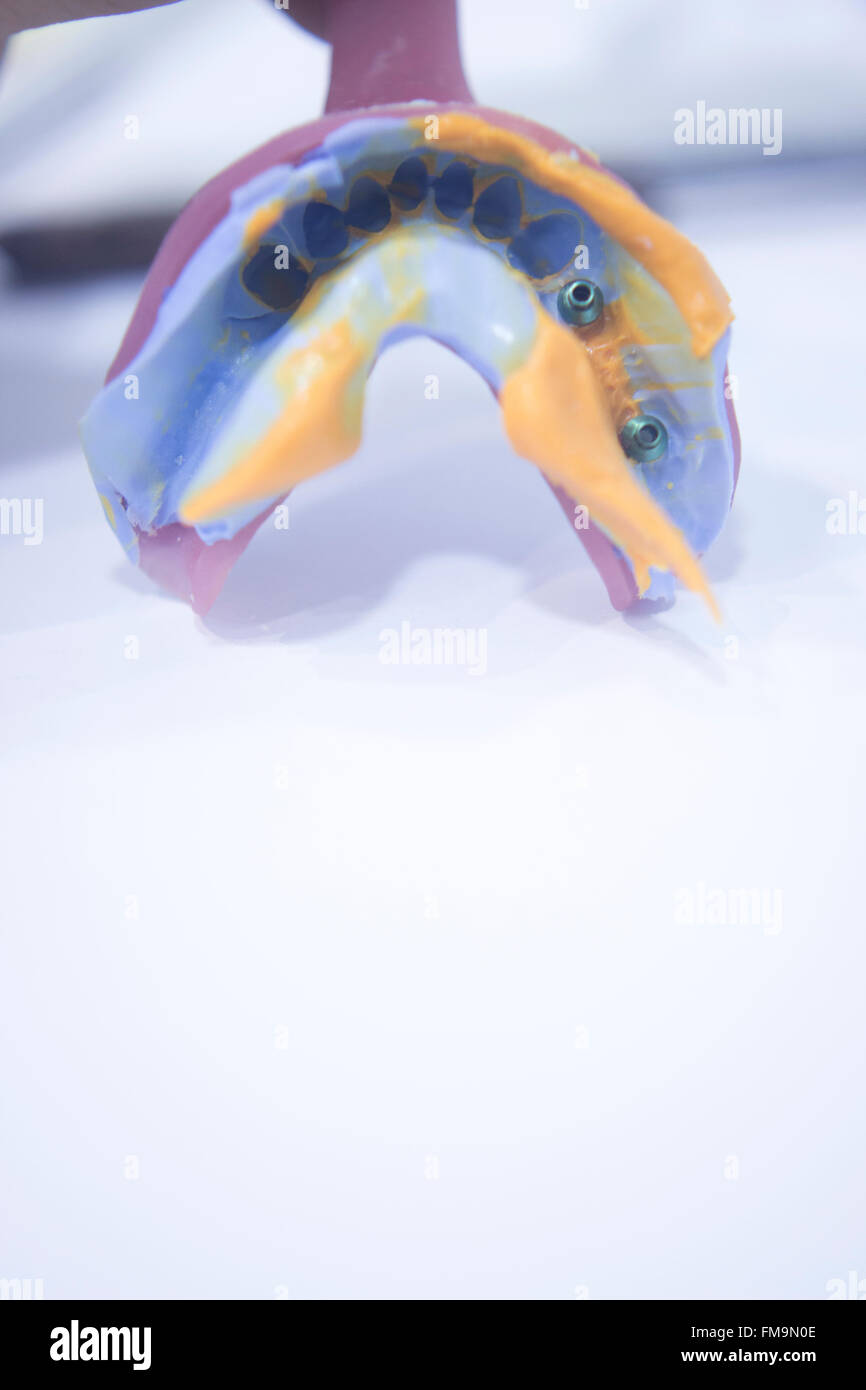 Dental moldings hi-res stock photography and images - Alamy