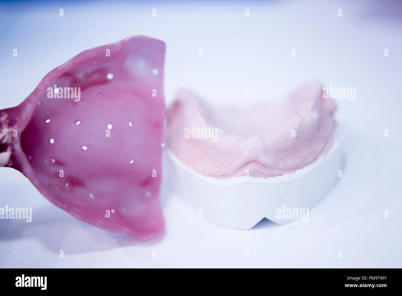Dental mold dental impression plate in dentist's clinic Stock Photo - Alamy