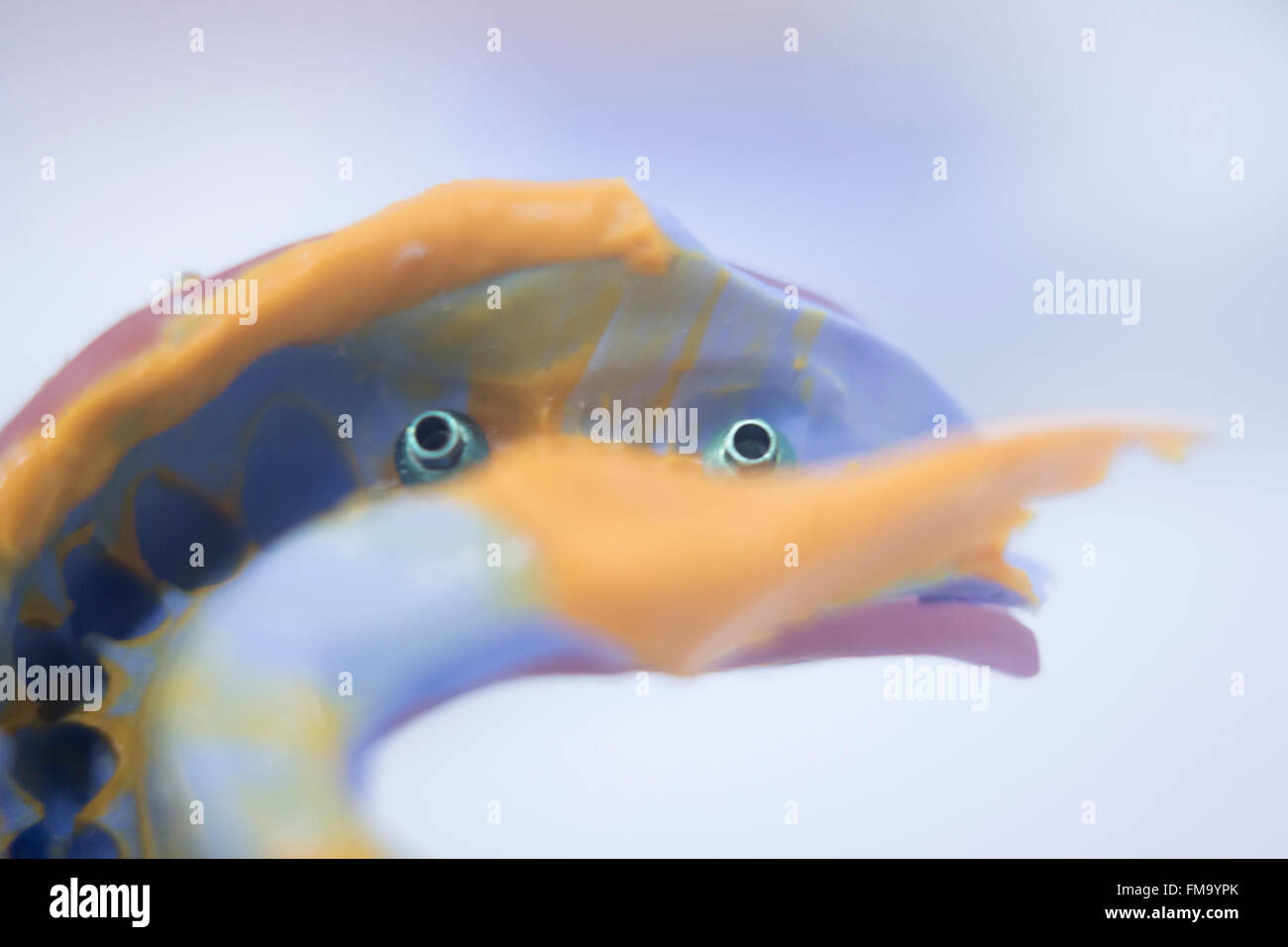 Dental mold dental impression plate in dentist's clinic Stock Photo - Alamy