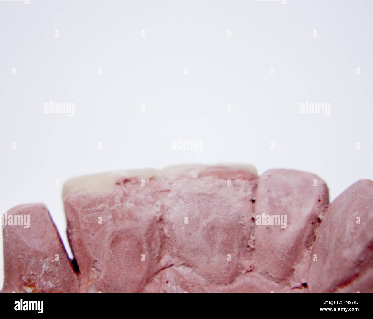 Dental prosthetics clay tooth mold in dentists laboratory photo Stock ...