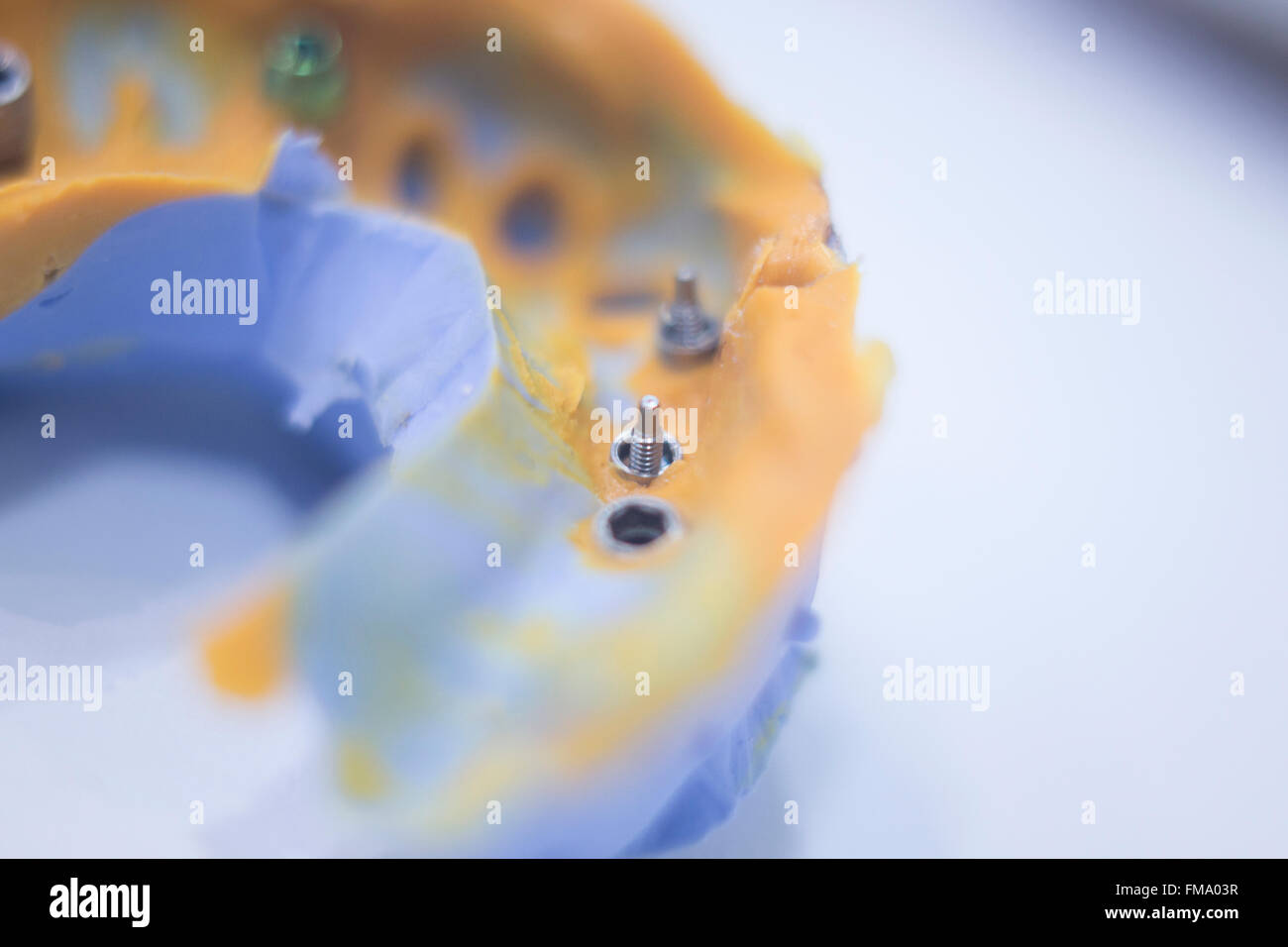 Dental mold dental impression plate in dentist's clinic Stock Photo - Alamy